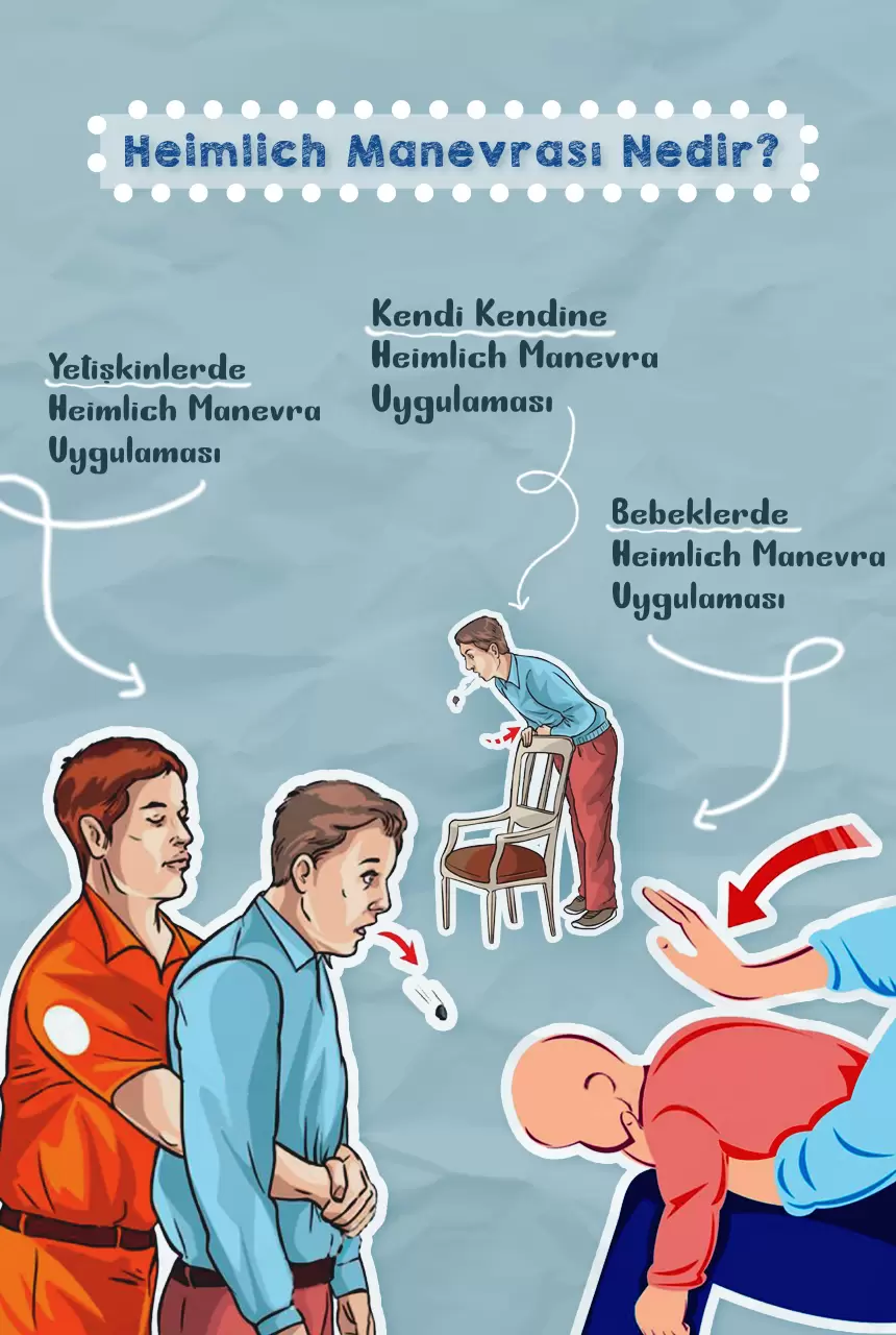 Heimlich Manevrası Nedir? Nasıl Uygulanır? - bilimUP Heimlich Manevrası Nedir? Nasıl Uygulanır? - bilimUP