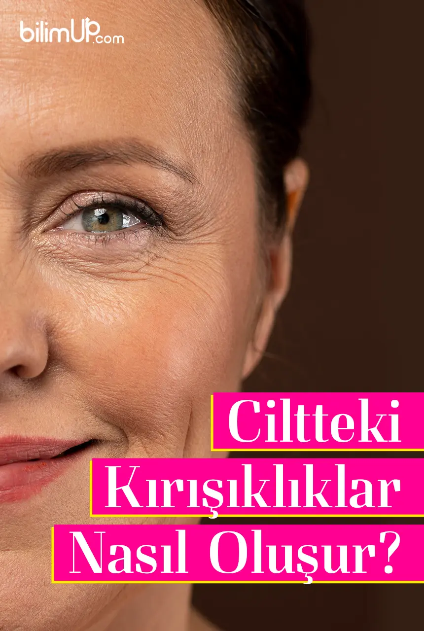 Ciltteki Kırışıklıklar Nasıl Oluşur? - bilimUP Ciltteki Kırışıklıklar Nasıl Oluşur? - bilimUP